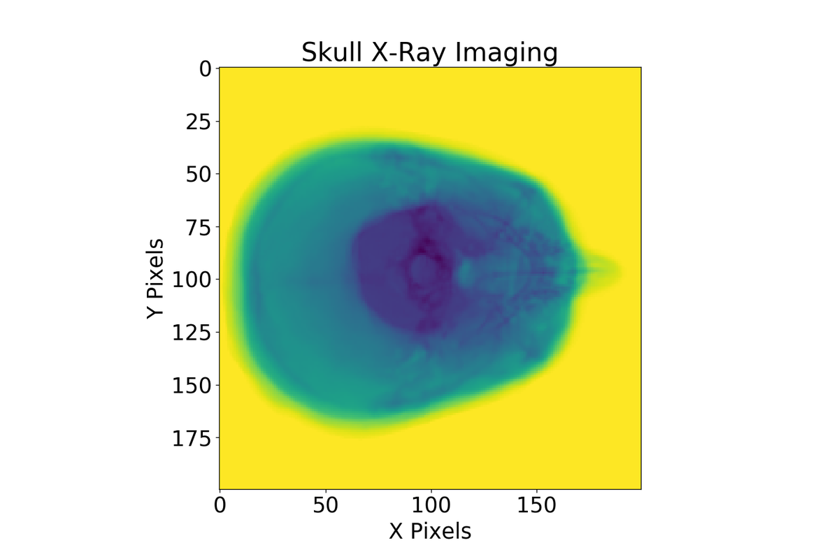 X-ray Imaging | Anthony Bisulco's Portfolio